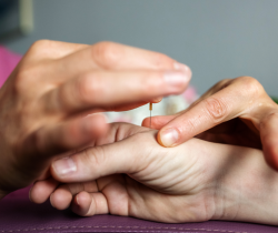 Acupuncture NZ - Acupuncture Awareness Day